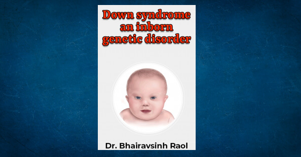 Down syndrome an inborn genetic disorder by Dr. Bhairavsinh Raol in ...